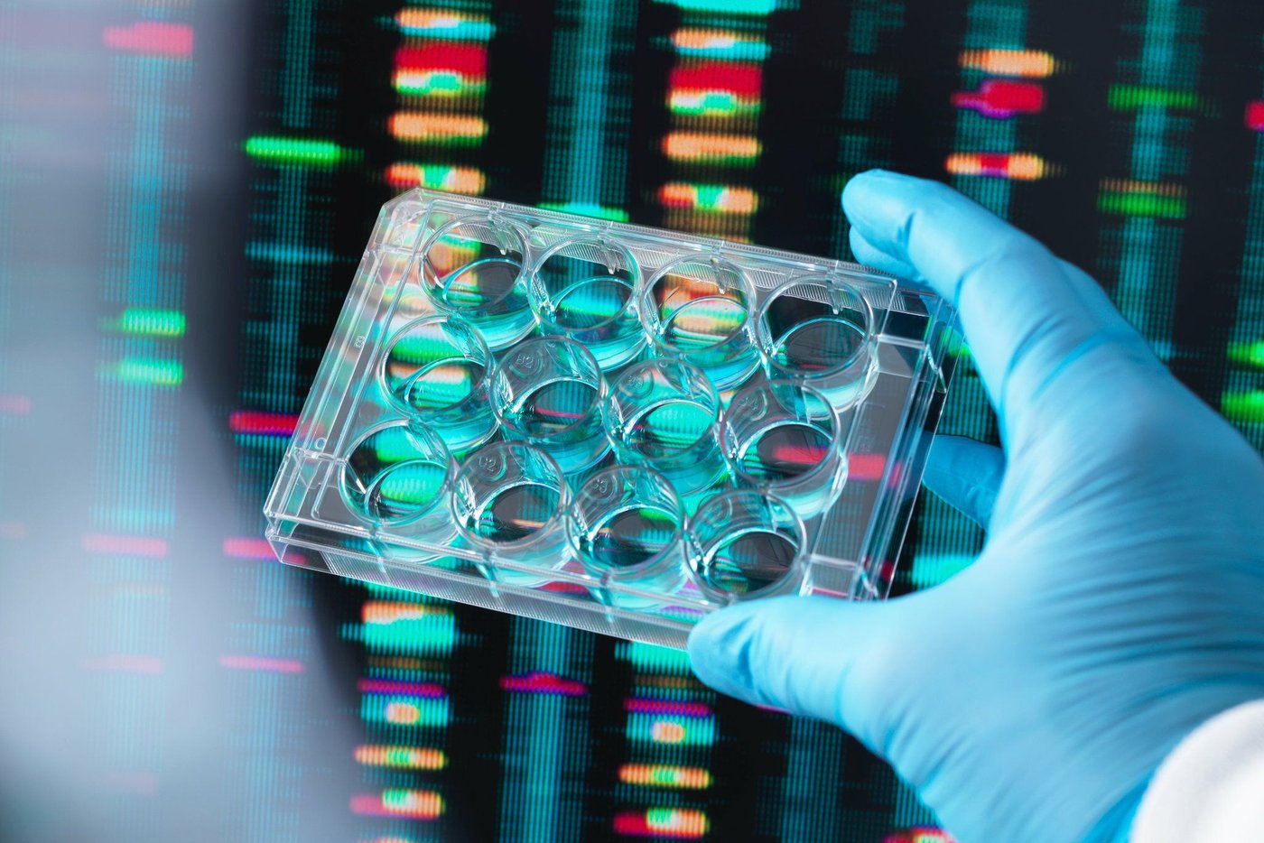 Miltenyi Biotec: Heimlicher Biotech-Star nähert sich der Umsatzmilliarde