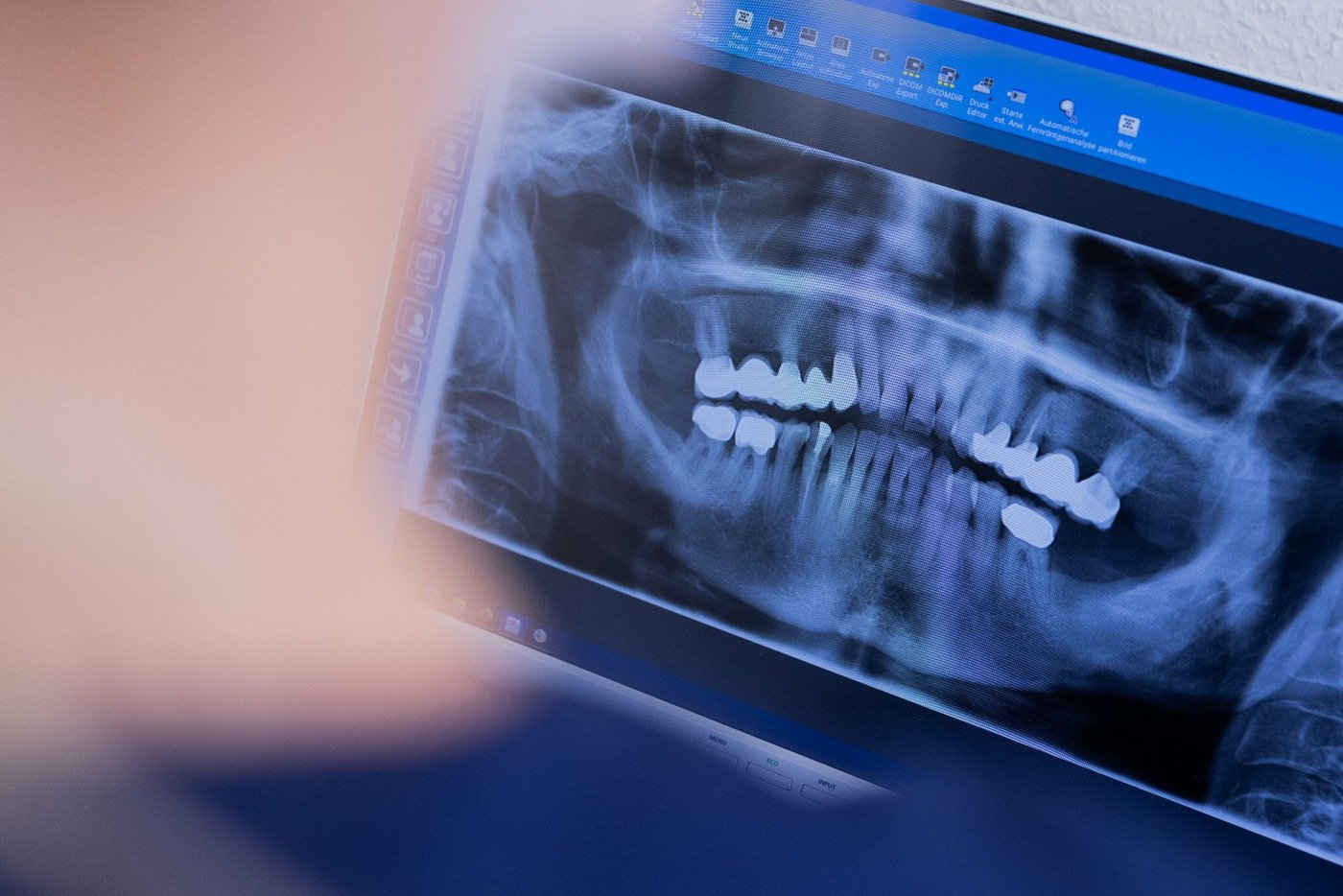 Siemens Healthineers: Neues MRT-Gerät für die Zahnmedizin