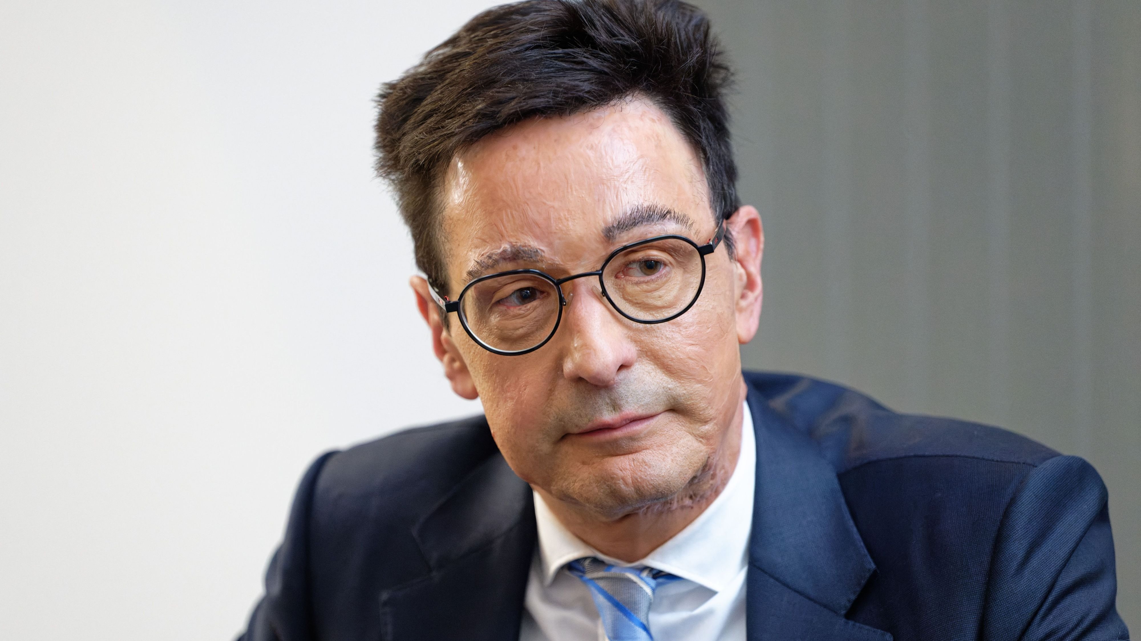 Säureanschlag auf Topmanager: „Sehr interessante Spur“ im Fall um Ex-Innogy-Manager Günther