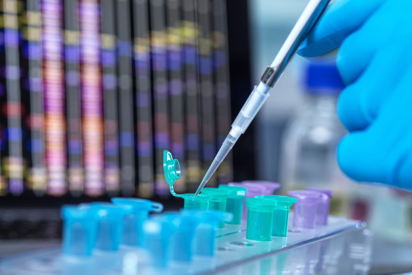 Arzneimittelbehörde: Ema empfiehlt erstmals Zulassung einer Genscheren ... Arzneimittelbehörde: Ema empfiehlt erstmals Zulassung einer Genscheren ...