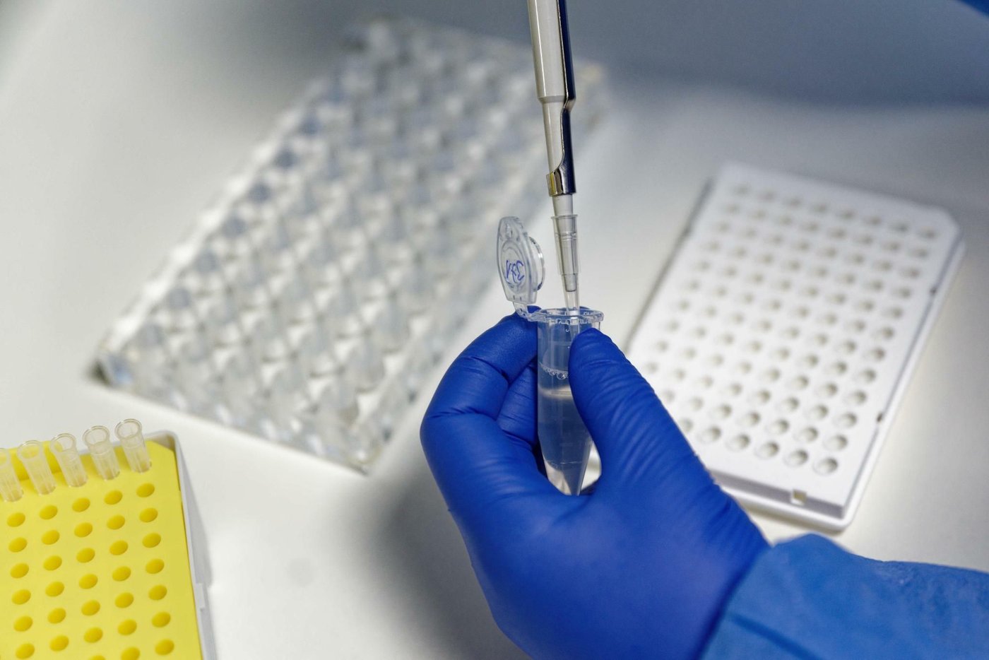 Corona-Test positiv: Was bedeutet der CT-Wert?
